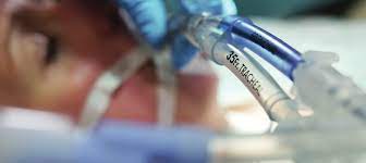 New Broncoflex - Alpha MedTech Limited