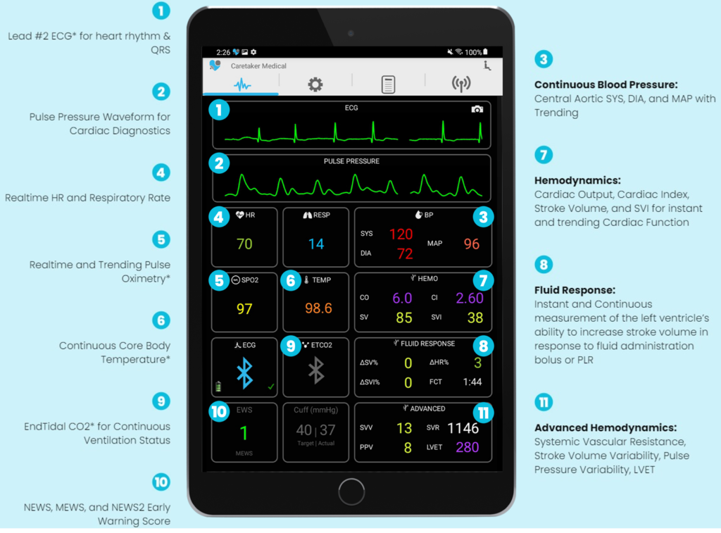 Caretaker® Wireless Continuous Blood Pressure & Vital Signs Monitor ...